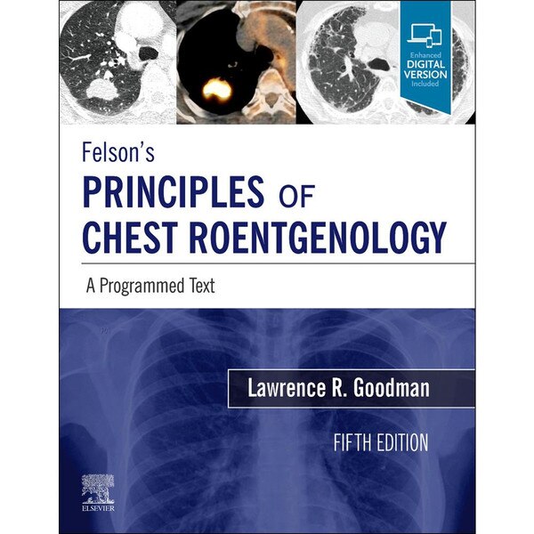Felson's Principles of Chest Roentgenology, A Programmed Text: A ...